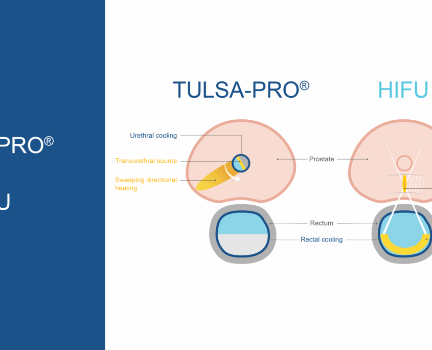 Blog | Profound Medical